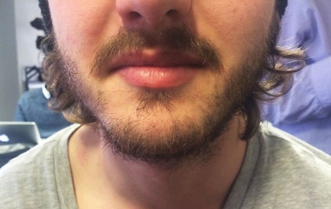 Study reveals beards could contain more bacteria than a toilet | Notts ...